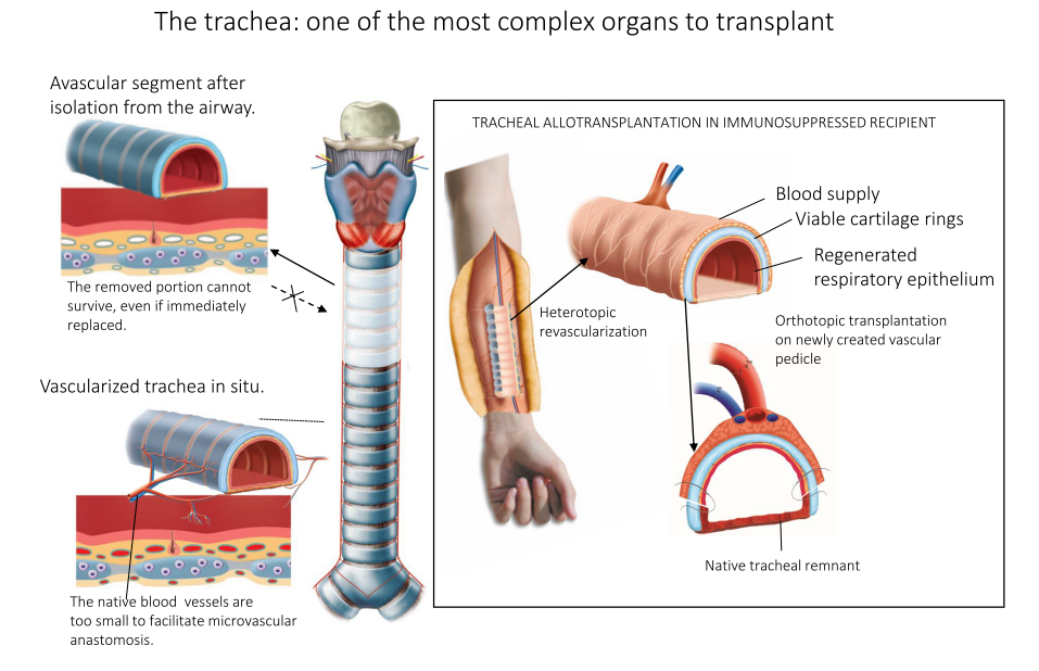 How UCL throat surgeon Martin Birchall misleads patients and tricks ...