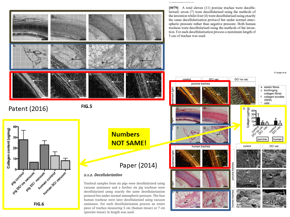Image reuse, the new low of UCL trachea transplanter Martin Birchall ...