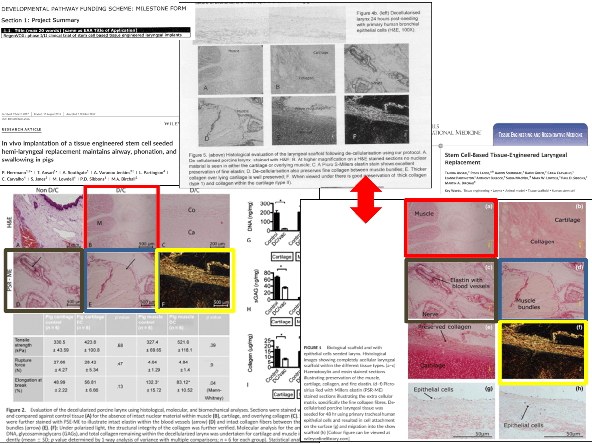 Image reuse, the new low of UCL trachea transplanter Martin Birchall ...